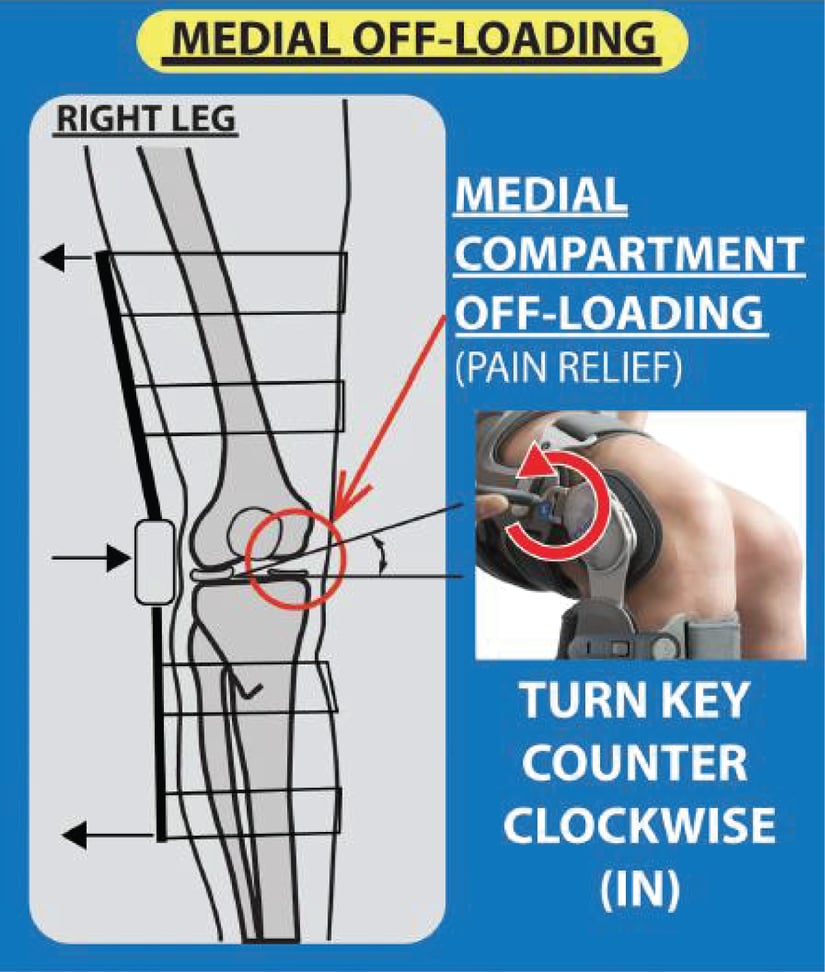 Product Highlight: Ovation Medical Game Changer Knee Brace